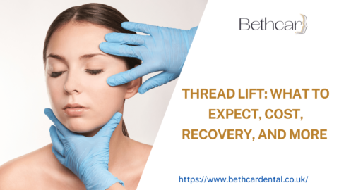 Thread Lift: What To Expect, Cost, Recovery, And More - Dentist Ebbw ...